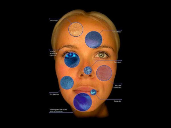 Services - Laser Light Skin Clinic