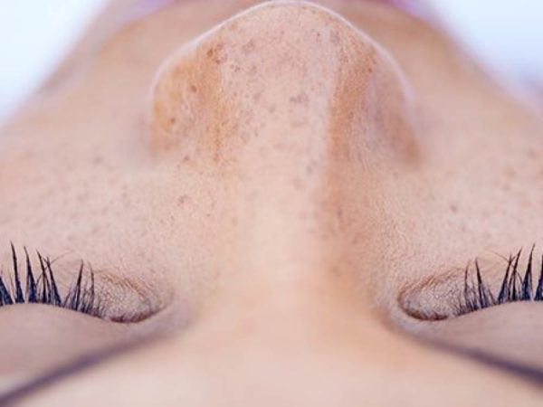 Services - Laser Light Skin Clinic