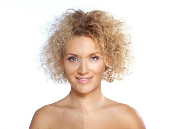 Services - Laser Light Skin Clinic