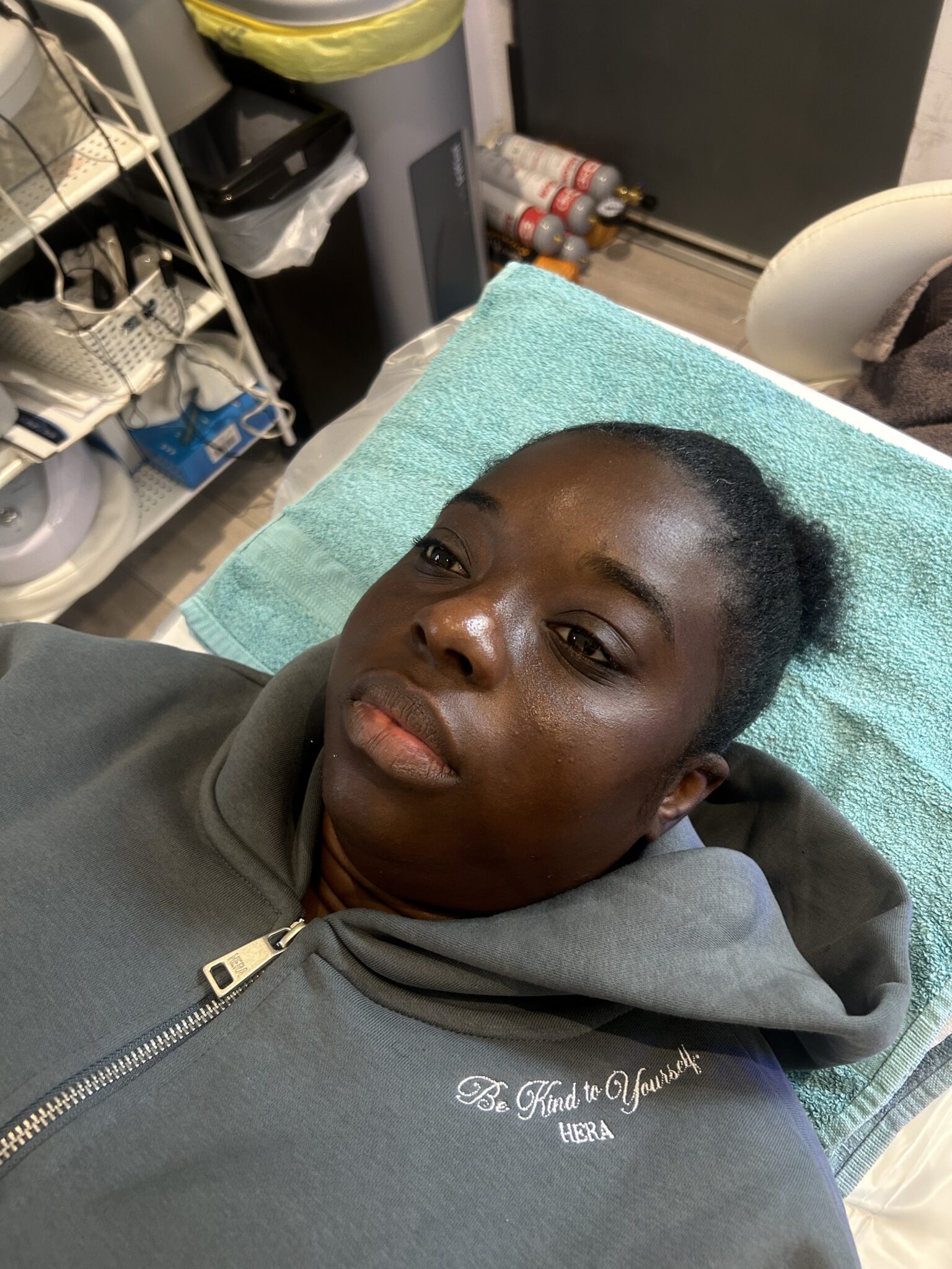 Laser Light Skin Clinic - Lip Fillers, Botox, Lemon Bottle, Lumi Eyes ...